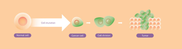 Kidneys & Kidney Cancer Basics - Kidney Cancer Association