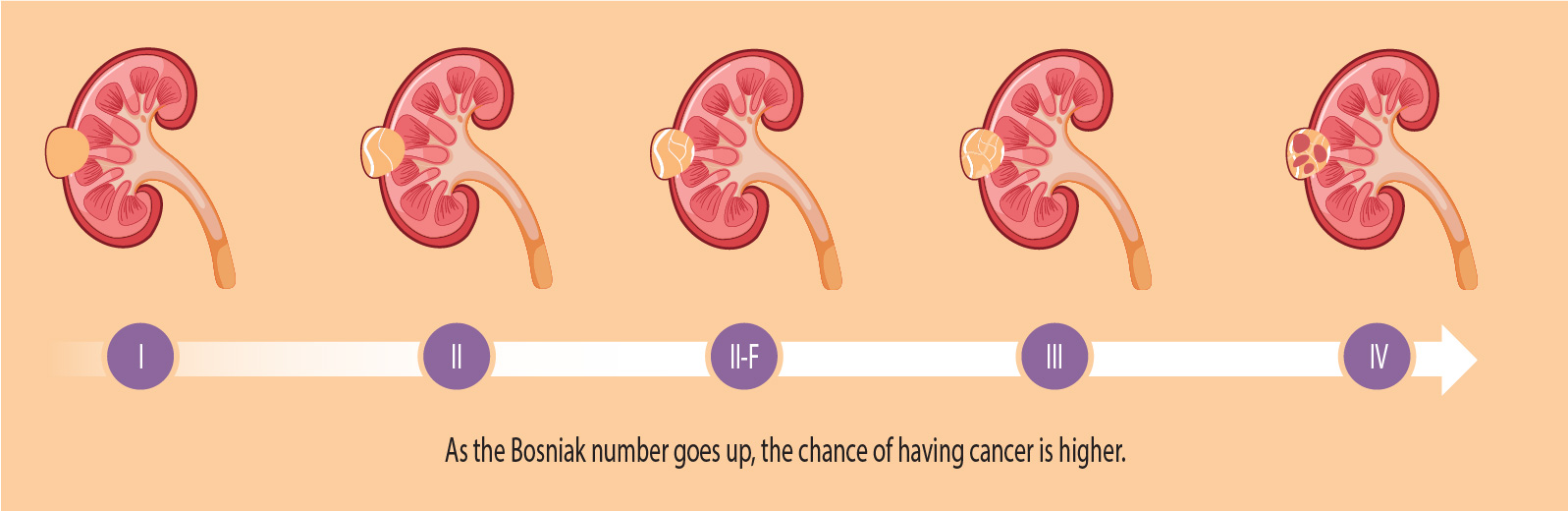 Block Test Page - Kidney Cancer Association